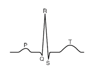 Understanding ECGs - almostadoctor
